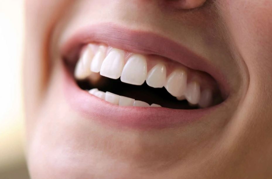 The Advantageous of Veneer Teeth: A Sydney Dentist's Perspective
